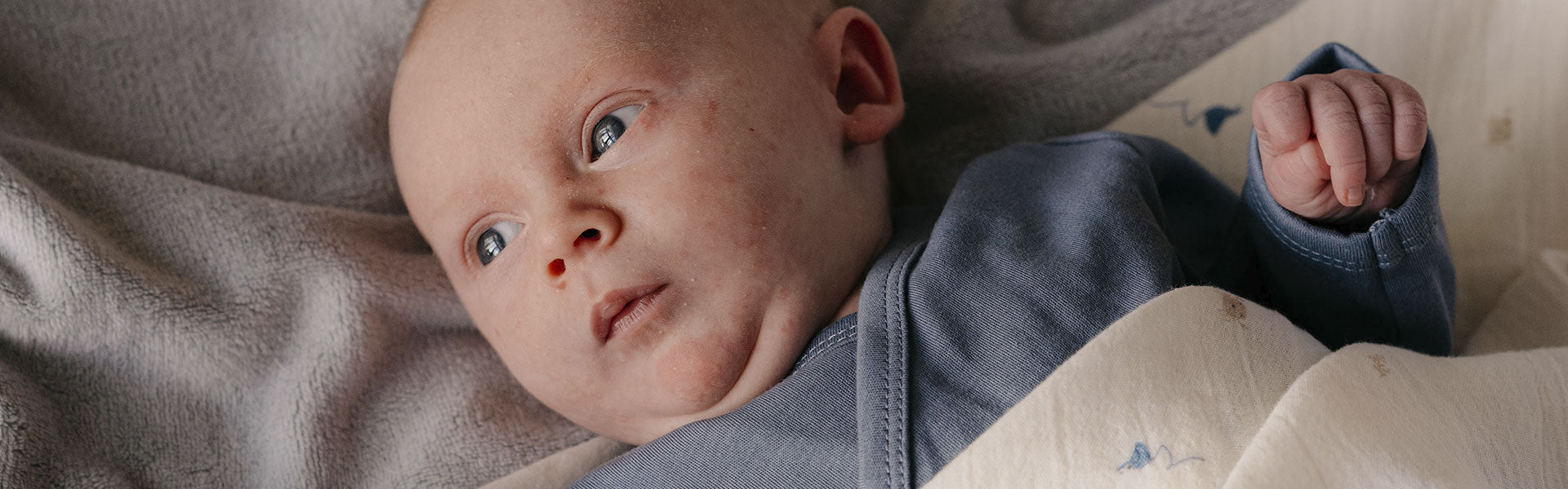 Eczeem, een echte plaag! – Dreambaby